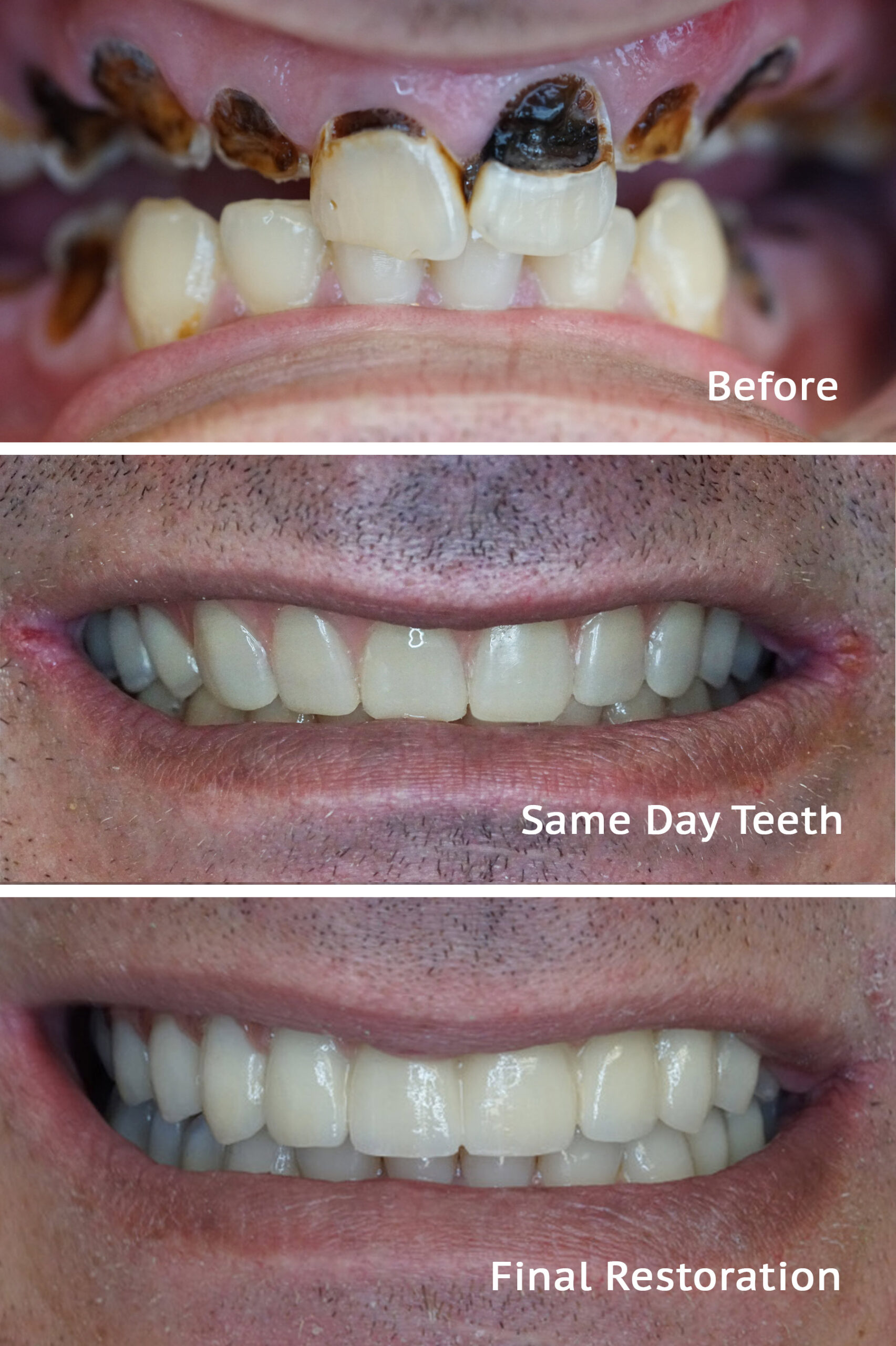 Before & After Photos | Aqua Dental | Boynton Beach, FL